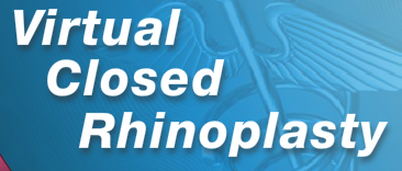 Surgery Squad: Virtual Closed Rhinoplasty - Play Online on Flash Museum 🕹️